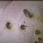 कबूतर मध्ये हिरव्या कचरा: संभाव्य रोग आणि काय करावे, प्रतिबंध 339_1