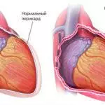 Viêm màng ngoài tim chấn thương: Tại sao có các triệu chứng, điều trị gia súc 6085_6
